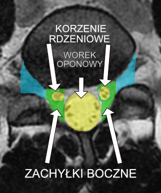 Zachyłek boczny kanału kręgowego » Andrzej Kroszczyński